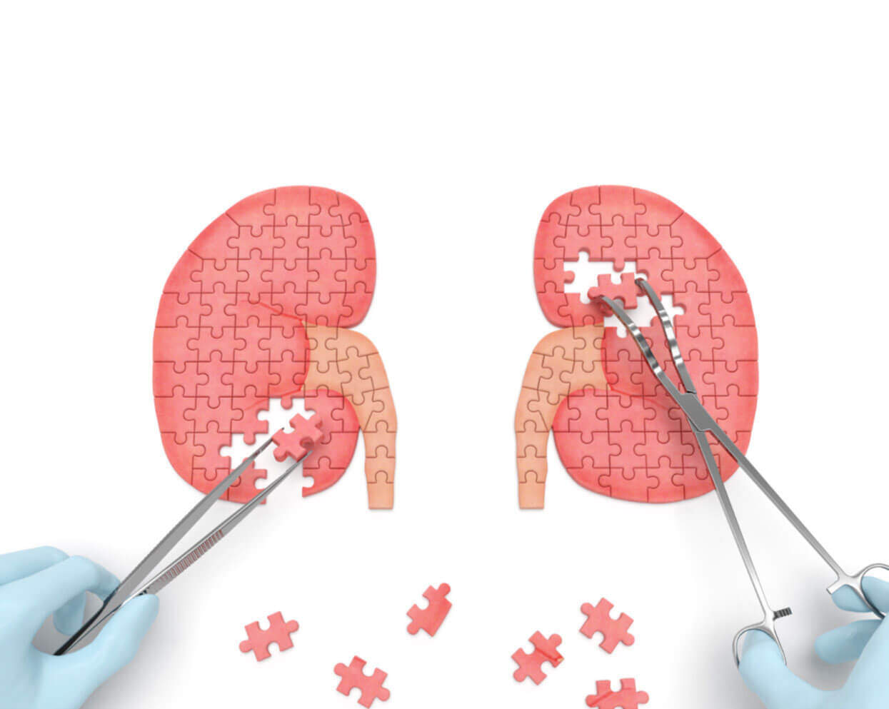 Insuficiencia renal: nefrólogo en Madrid | Centro médico MipSalud